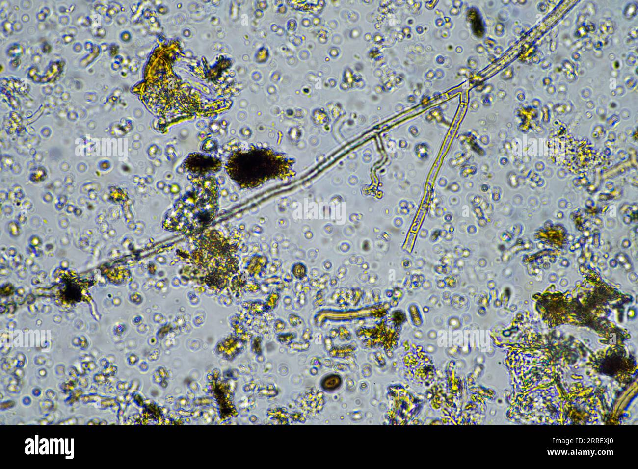 Fungal and fungi hyphae under the microscope in the soil and compost ...