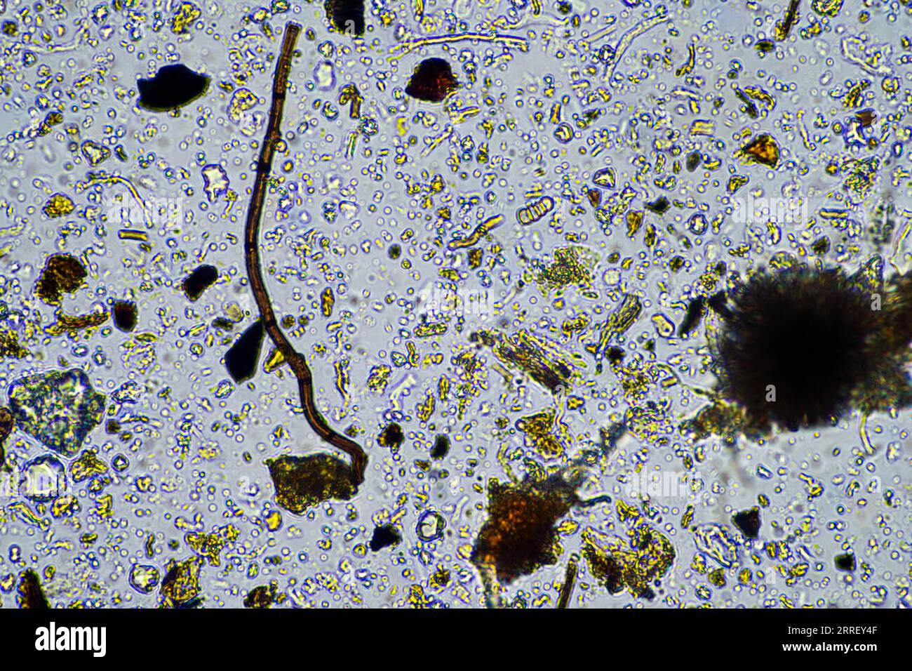 soil microorganisms close up under the microscope. in a soil samlple ...