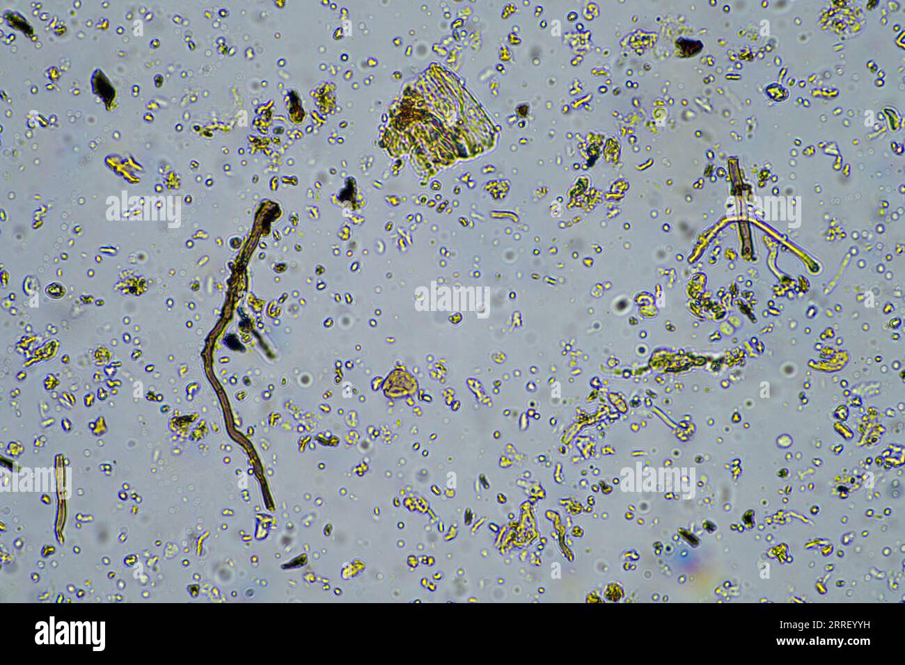 Fungal and fungi hyphae under the microscope in the soil and compost ...