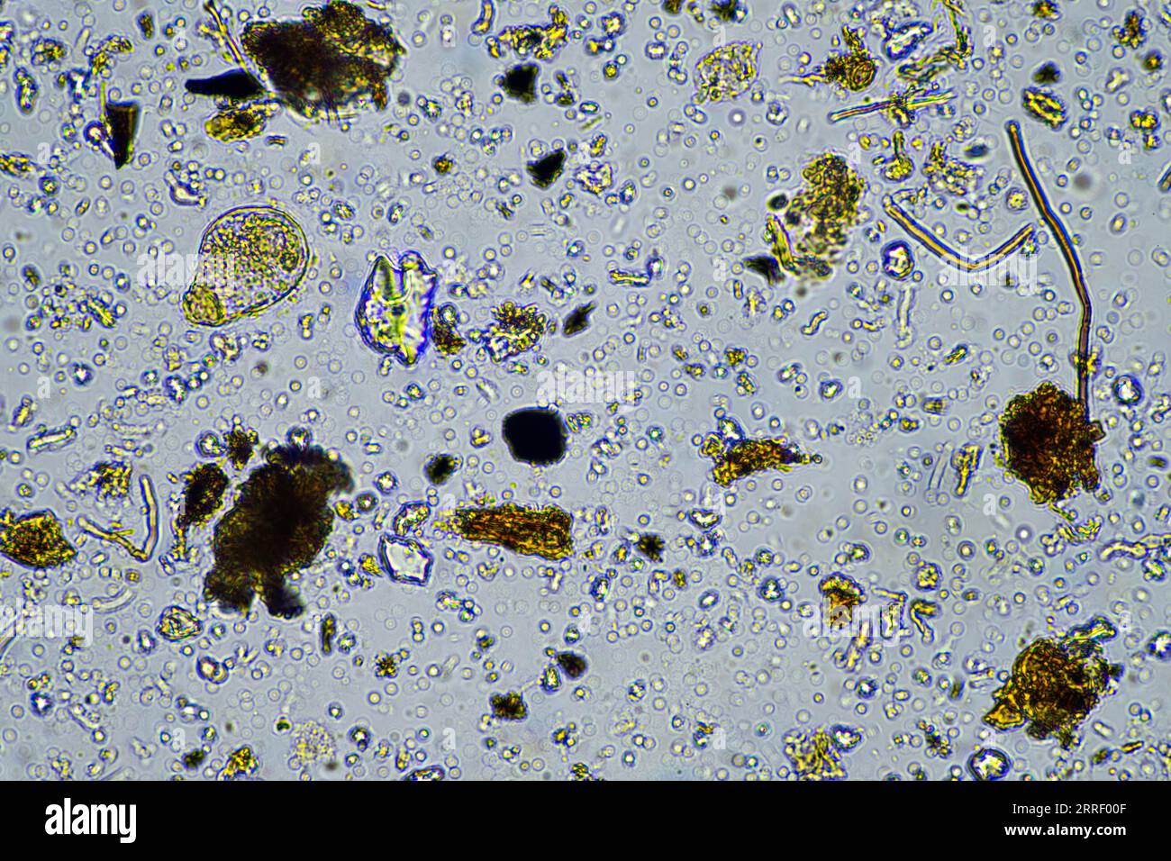 soil life under the microscope with soil fungi and fungal hyphae on a ...