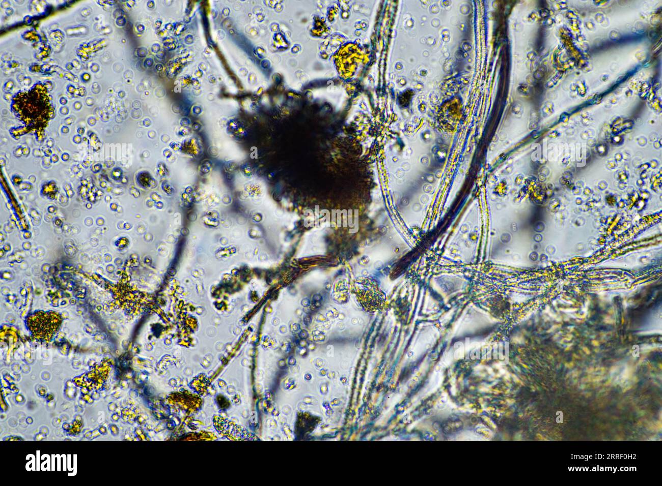 Phytophthora Infestans Microscope