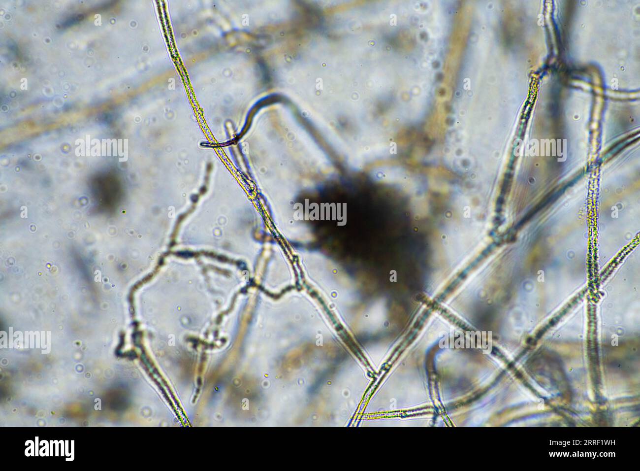 soil life under the microscope with soil fungi and fungal hyphae on a ...