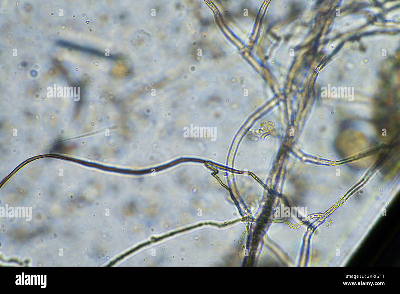 fungal hyphae and soil fungi in a soil sample, showing the living soil ...