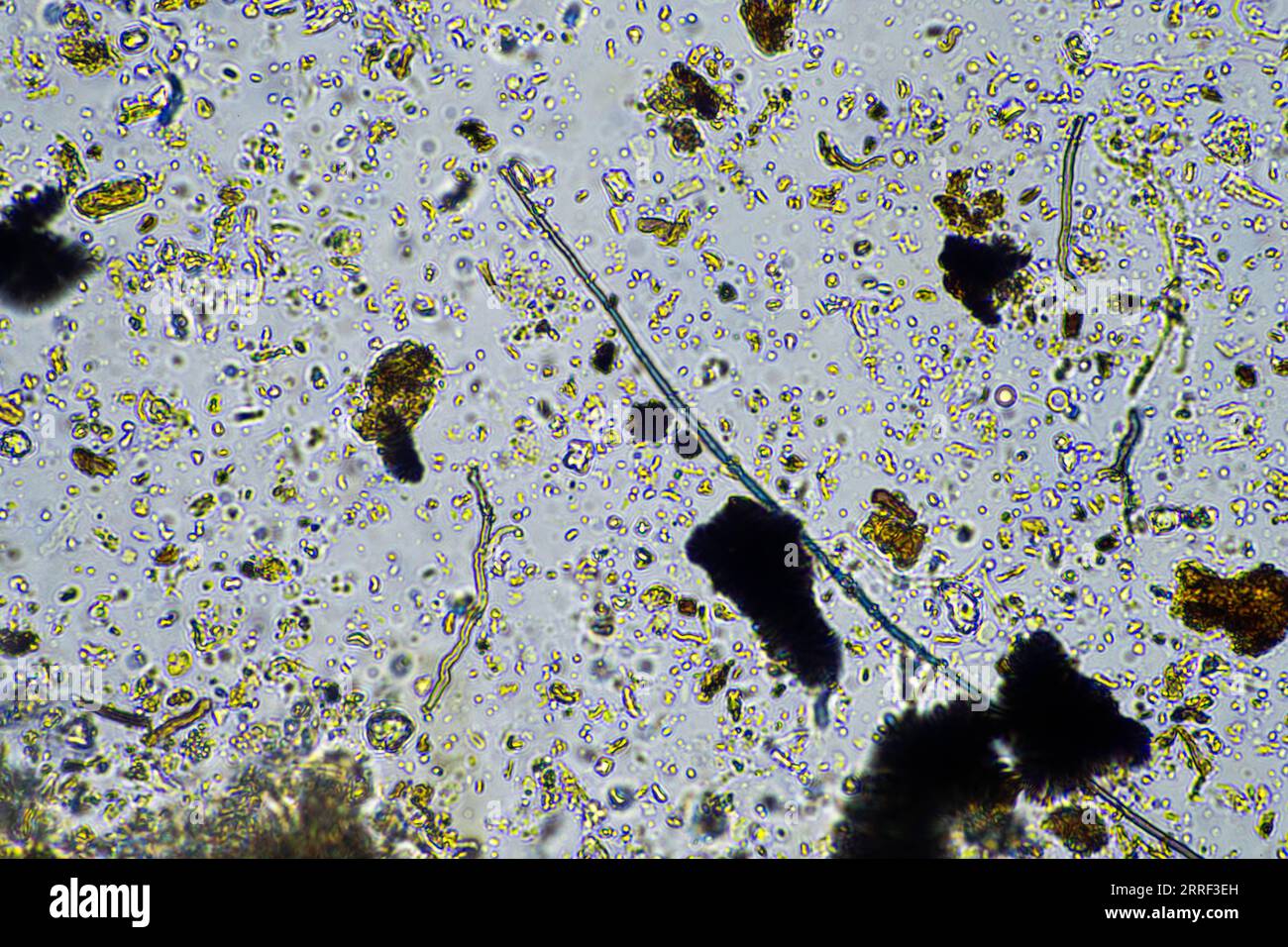 soil microorganisms close up under the microscope. in a soil samlple ...