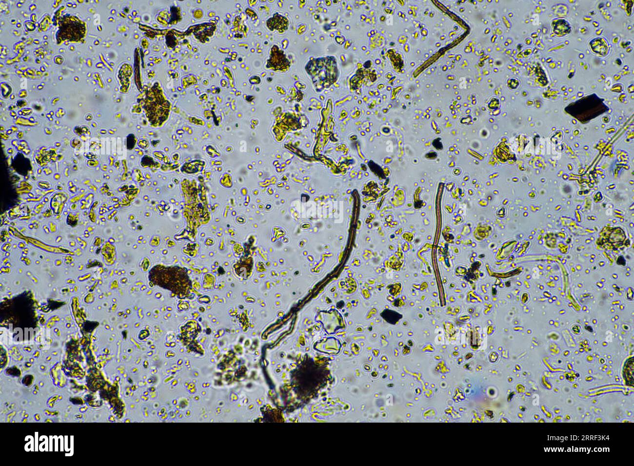 Fungal and fungi hyphae under the microscope in the soil and compost ...