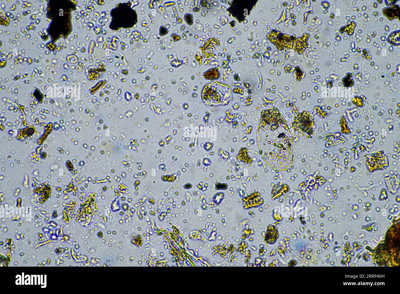 soil microorganisms close up under the microscope. in a soil samlple ...