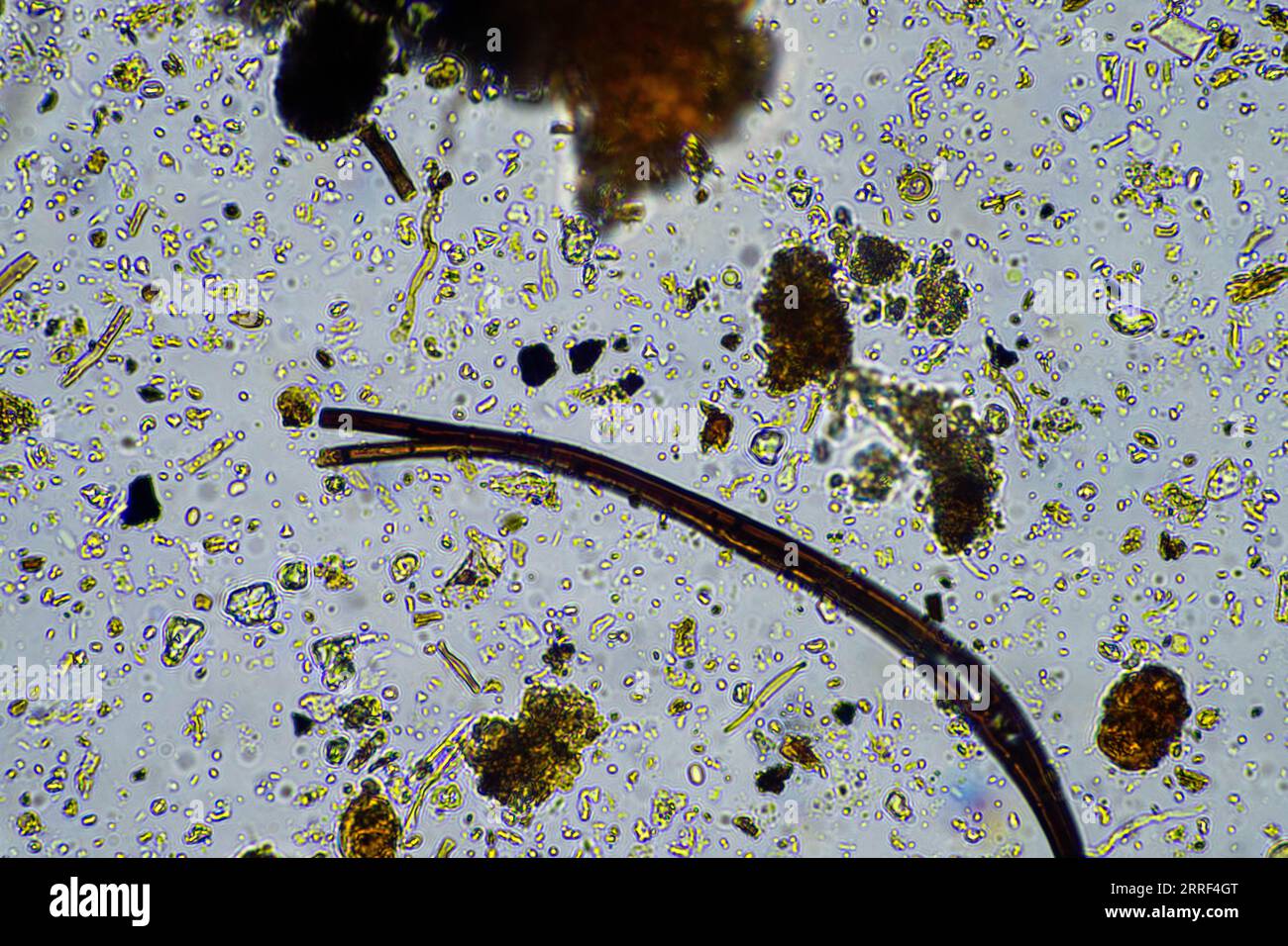 soil life under the microscope with soil fungi and fungal hyphae on a ...