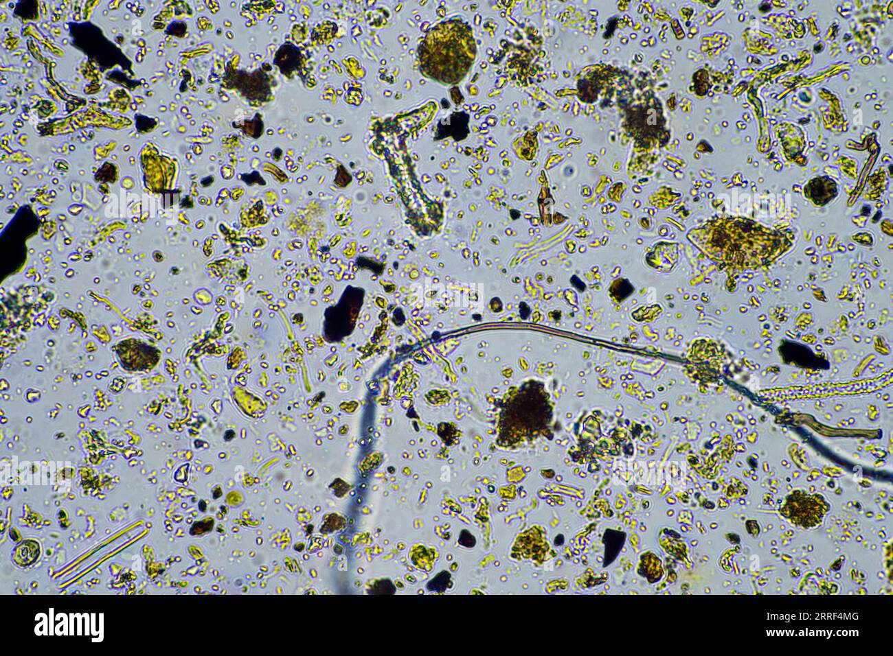 soil microorganisms close up under the microscope. in a soil samlple ...
