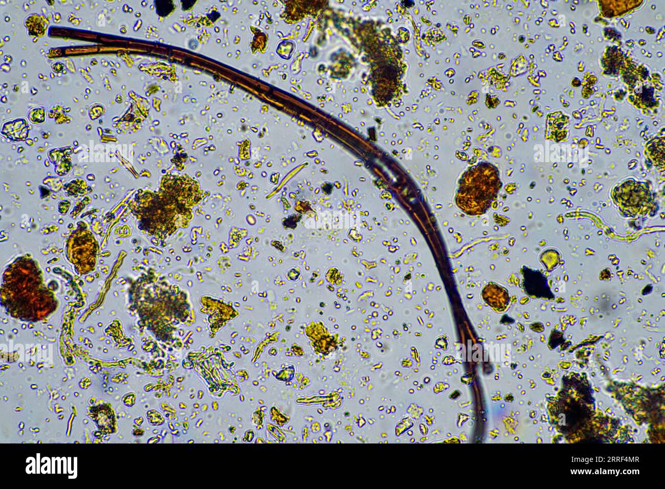 Fungal and fungi hyphae under the microscope in the soil and compost ...