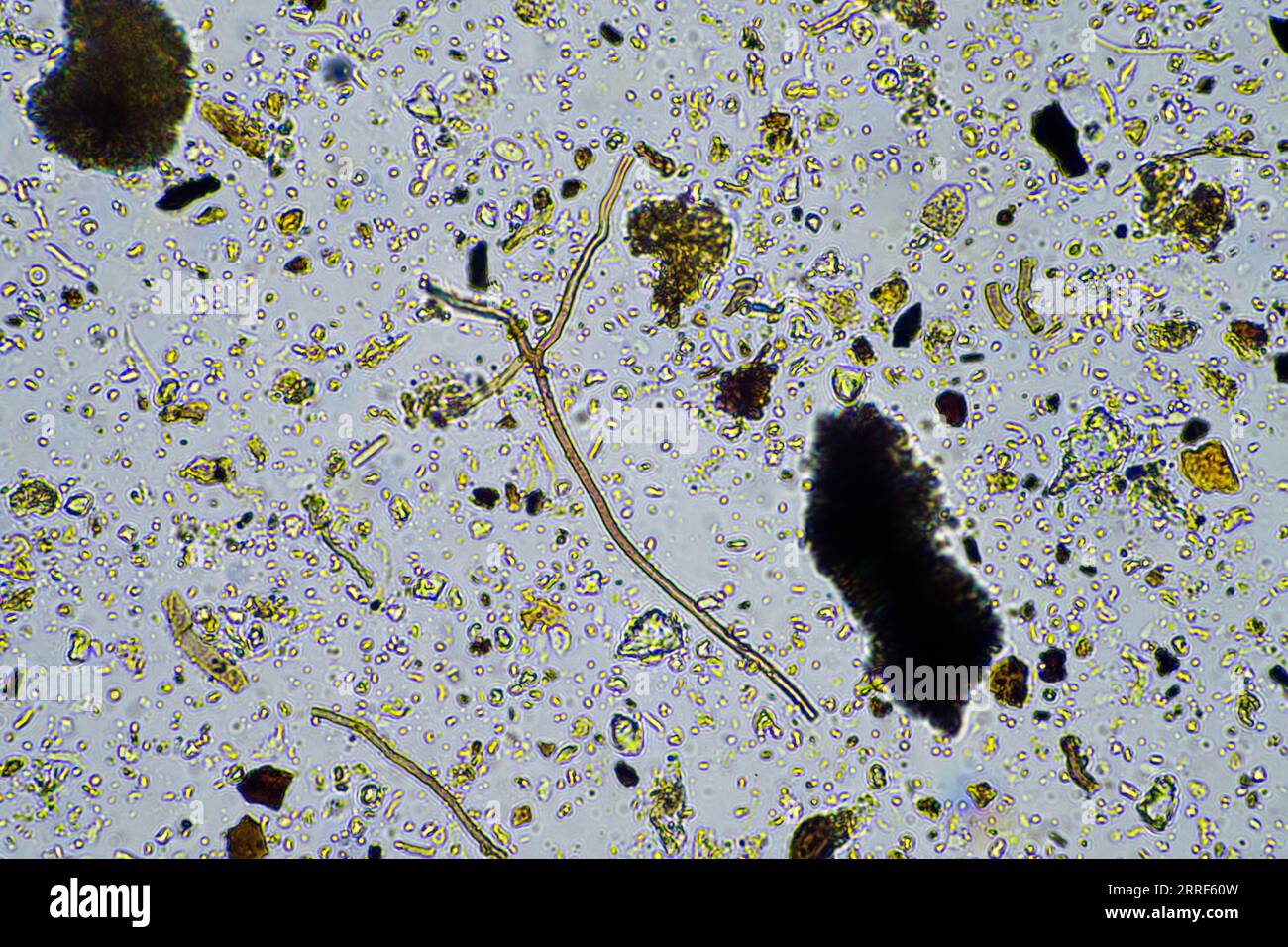 soil microorganisms close up under the microscope. in a soil samlple ...
