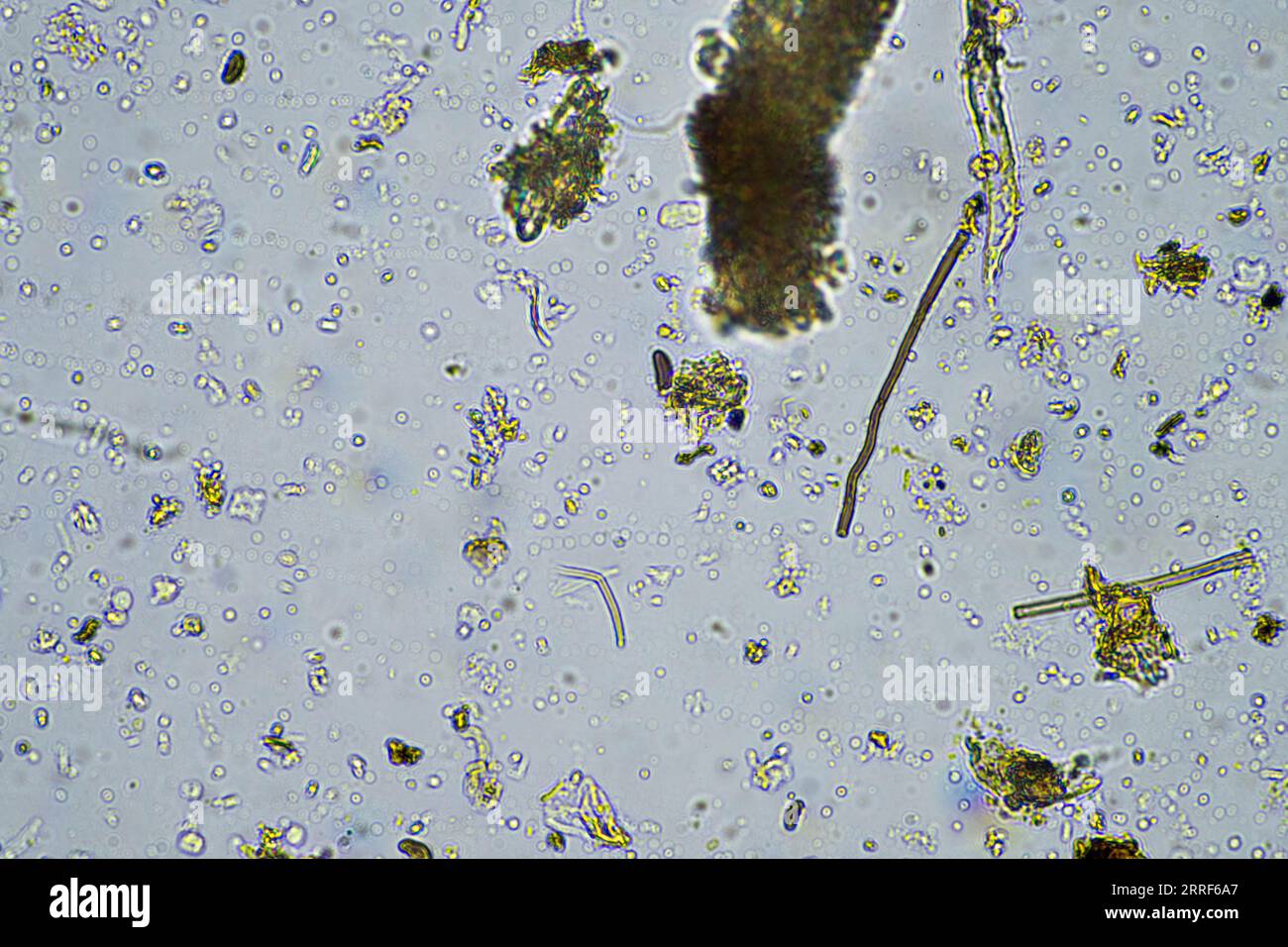 Fungal and fungi hyphae under the microscope in the soil and compost ...