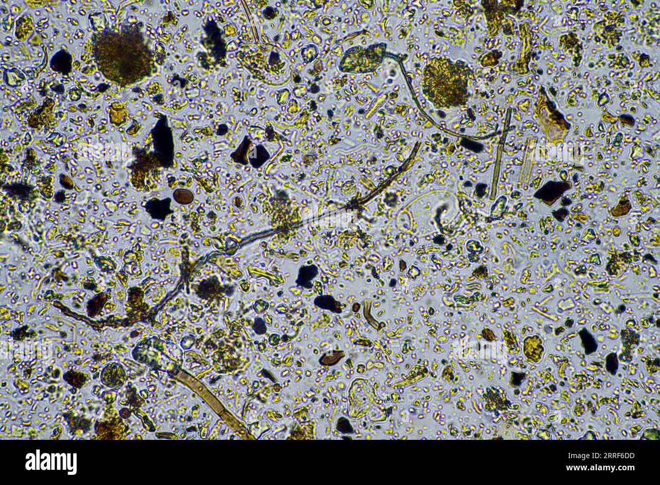 Fungal and fungi hyphae under the microscope in the soil and compost ...