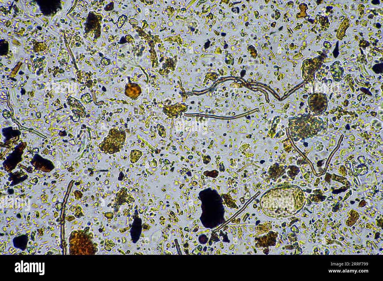 soil life under the microscope with soil fungi and fungal hyphae on a ...