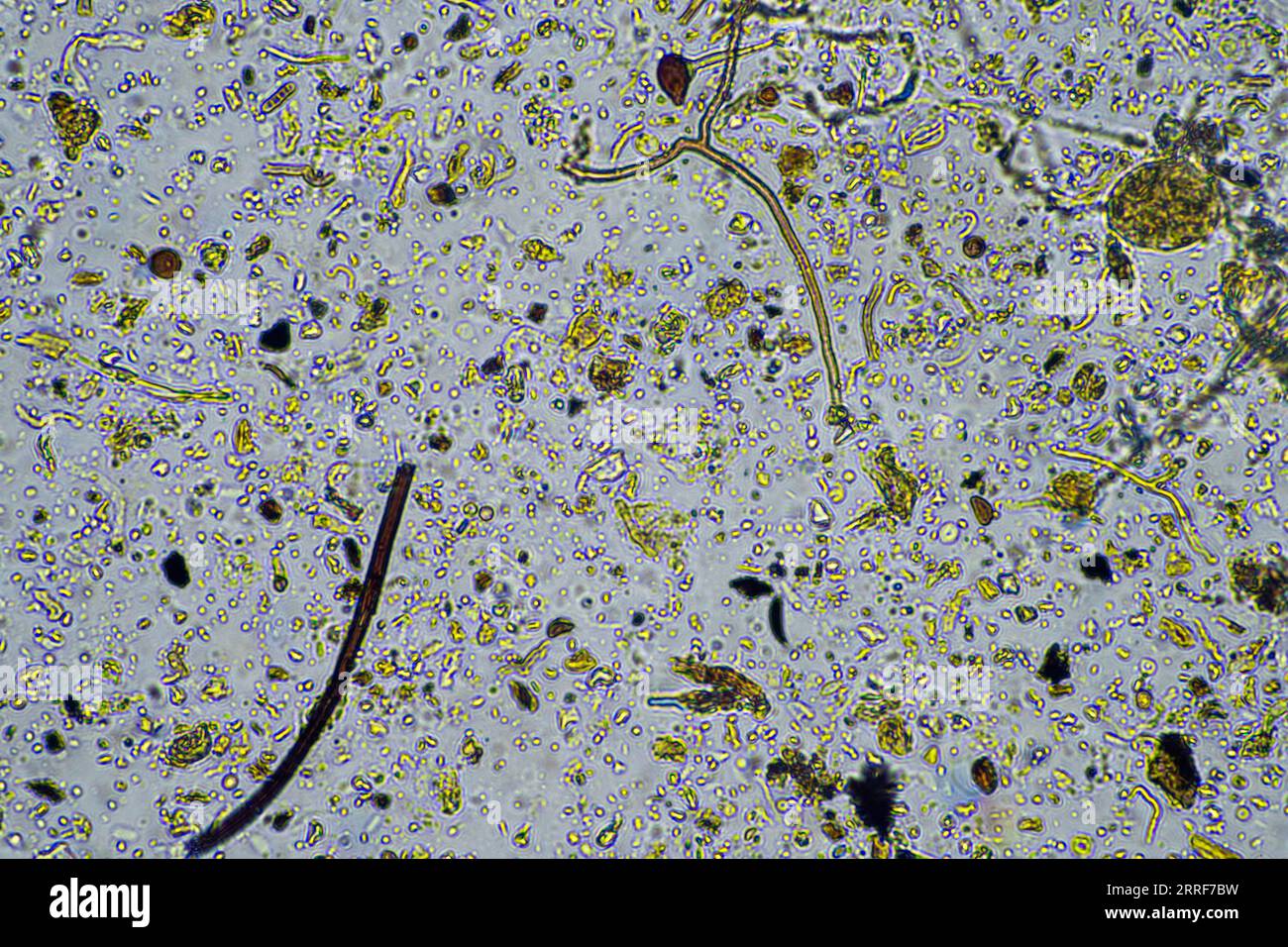 soil microorganisms close up under the microscope. in a soil samlple ...