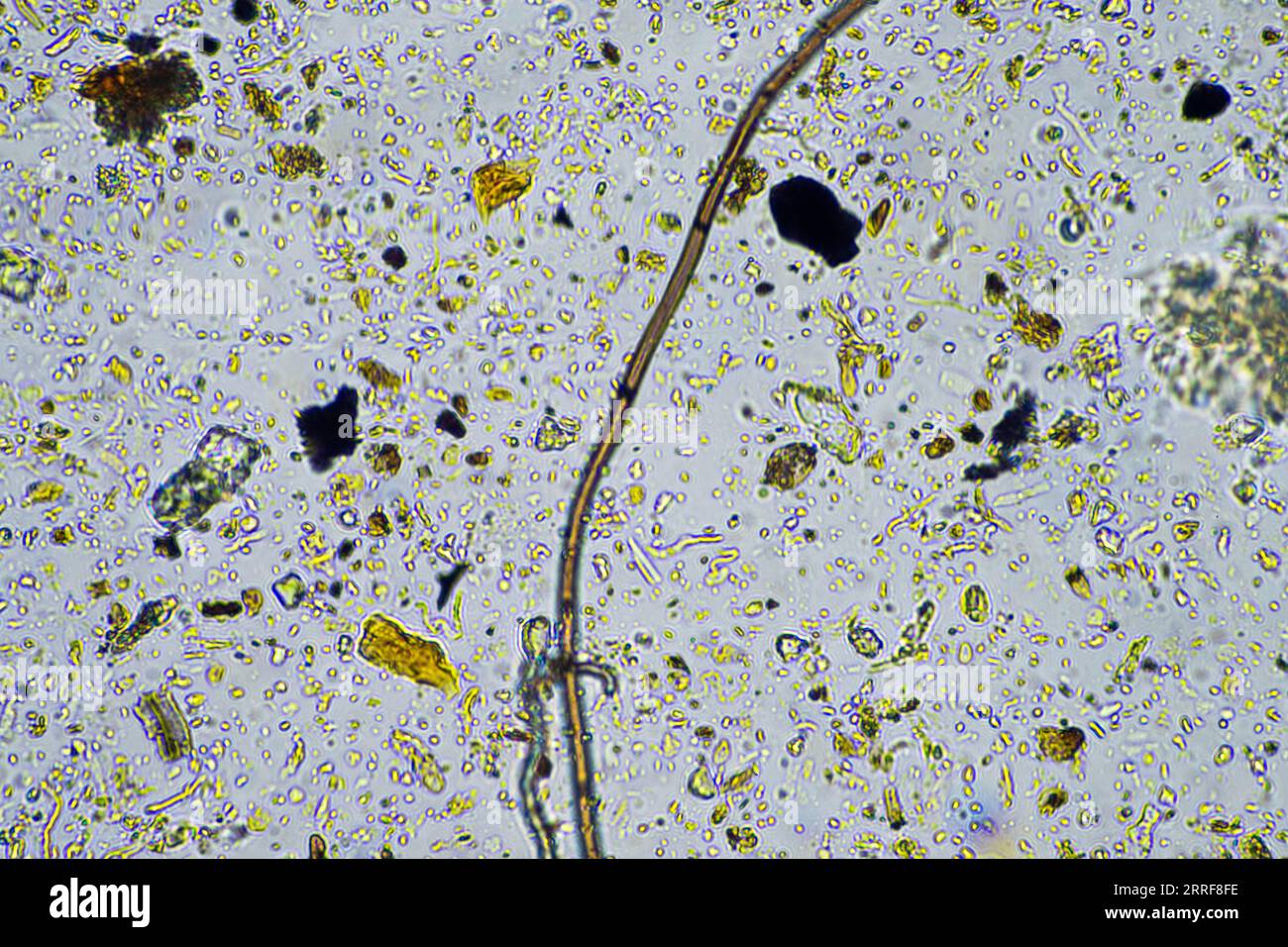 soil life under the microscope with soil fungi and fungal hyphae on a ...