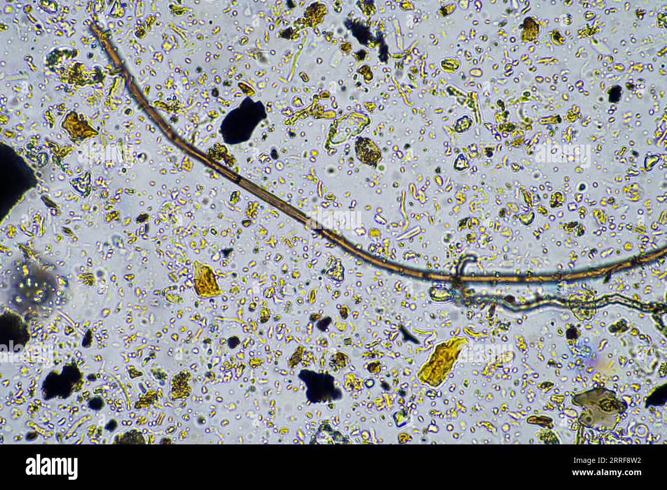 soil microorganisms close up under the microscope. in a soil samlple ...