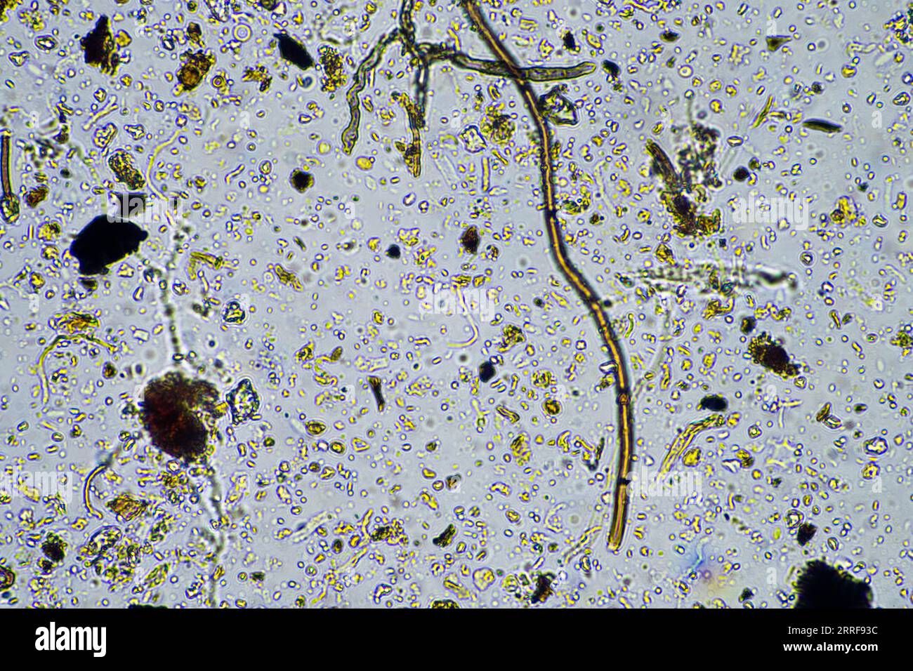Fungal and fungi hyphae under the microscope in the soil and compost, in a soil biology and ...