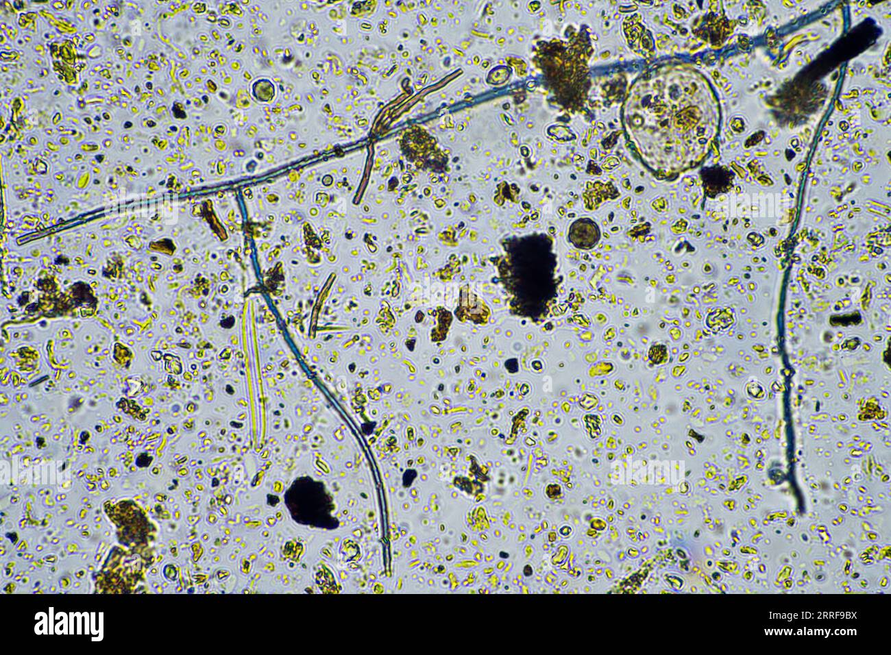 soil microorganisms close up under the microscope. in a soil samlple ...