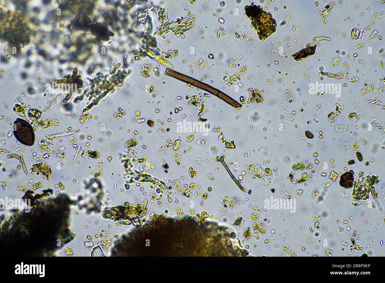 soil microorganisms close up under the microscope. in a soil samlple ...