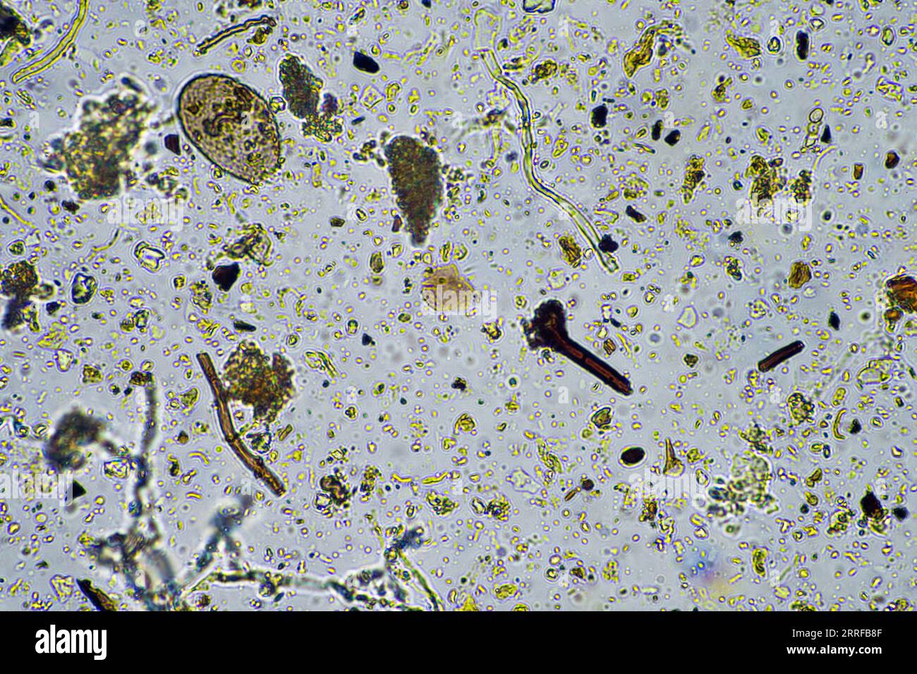 soil microorganisms close up under the microscope. in a soil samlple ...