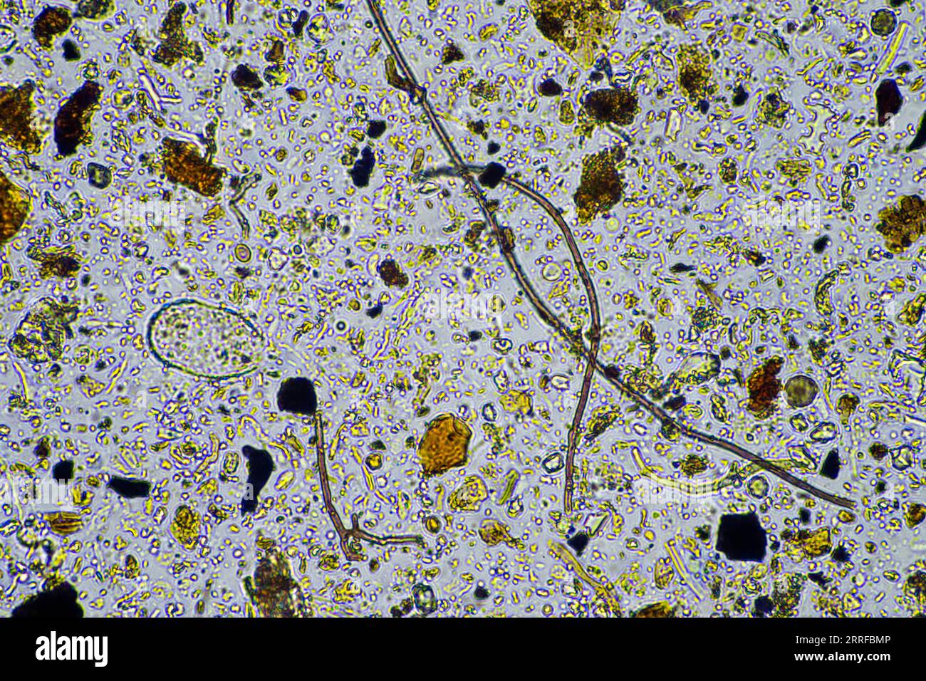 Fungal and fungi hyphae under the microscope in the soil and compost ...