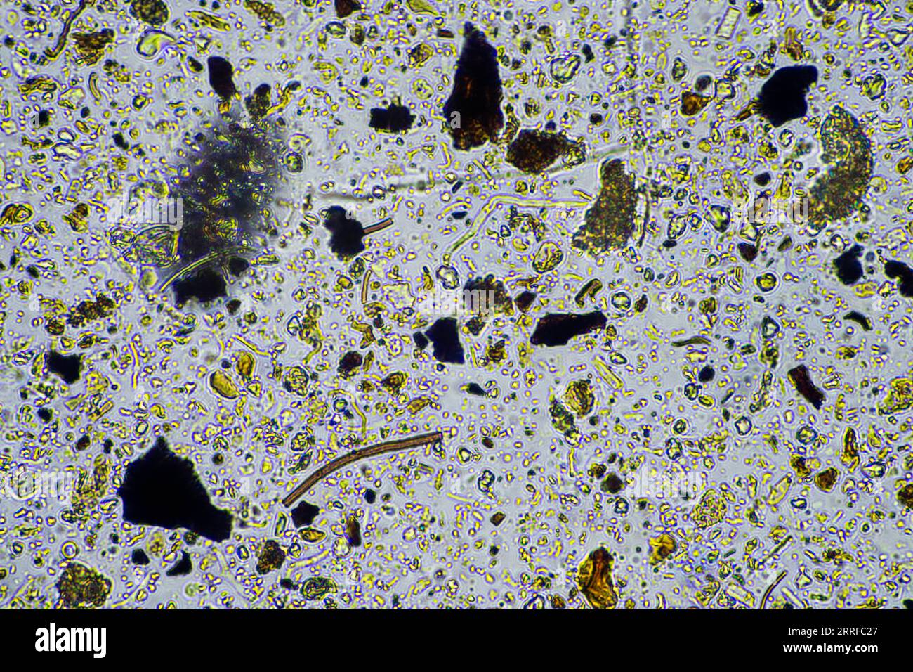 soil microorganisms close up under the microscope. in a soil samlple ...