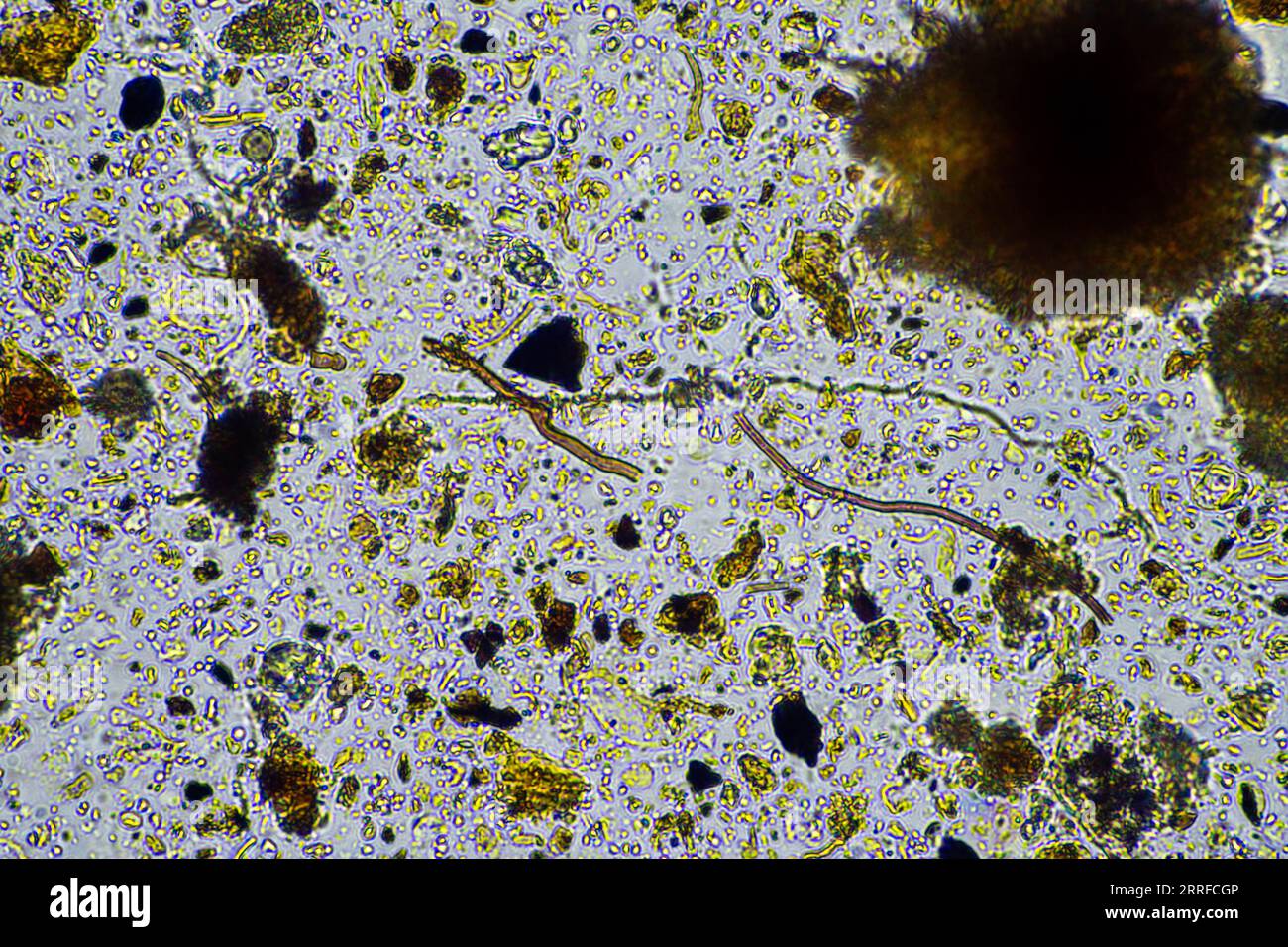 soil life under the microscope with soil fungi and fungal hyphae on a ...