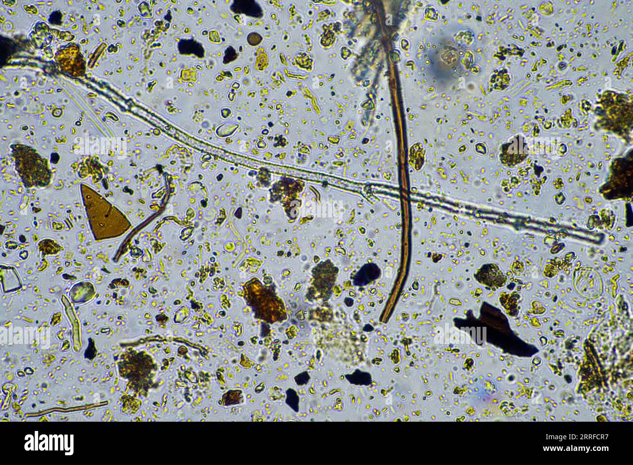 soil microorganisms close up under the microscope. in a soil samlple ...