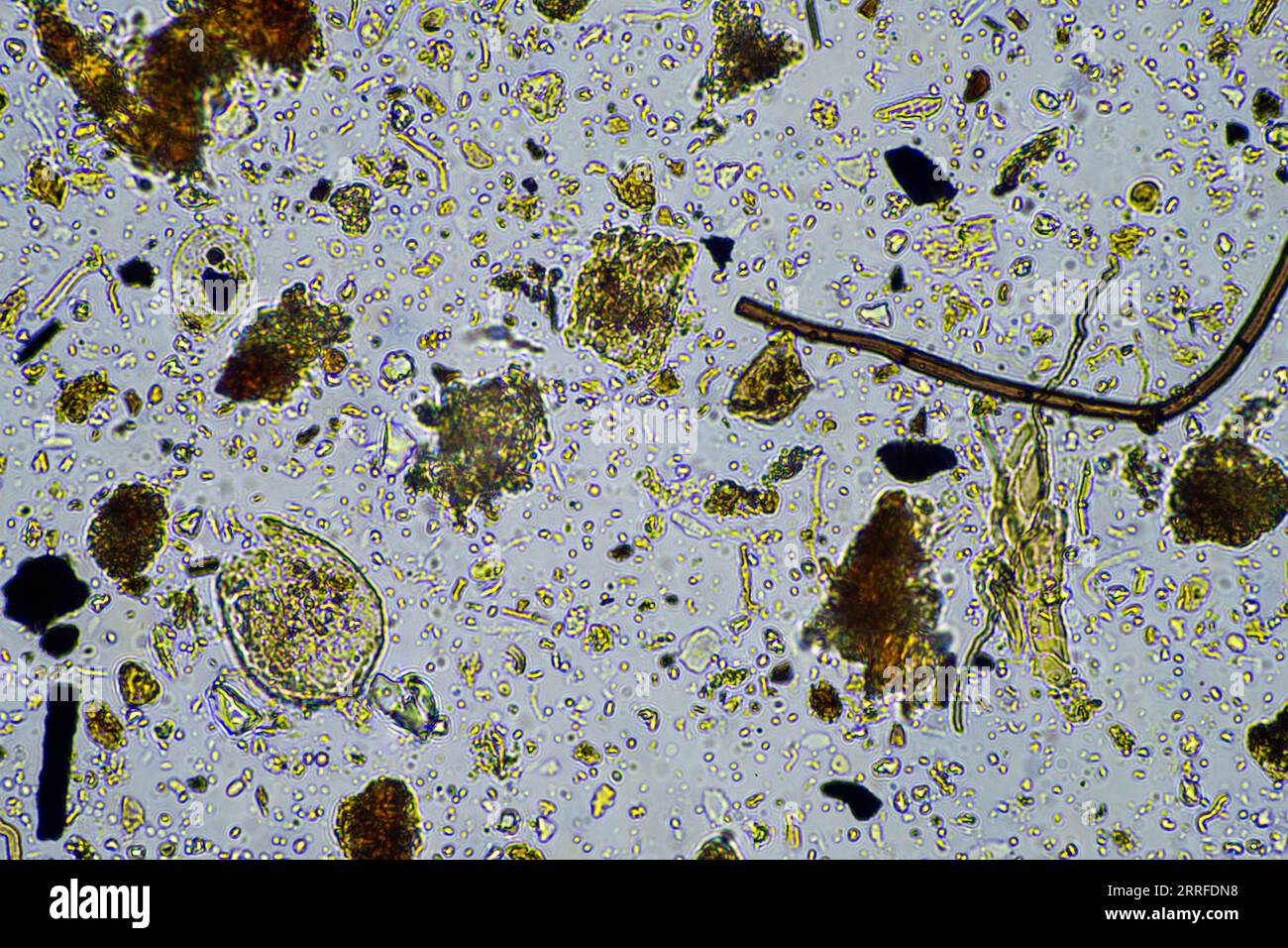 soil microorganisms close up under the microscope. in a soil samlple ...