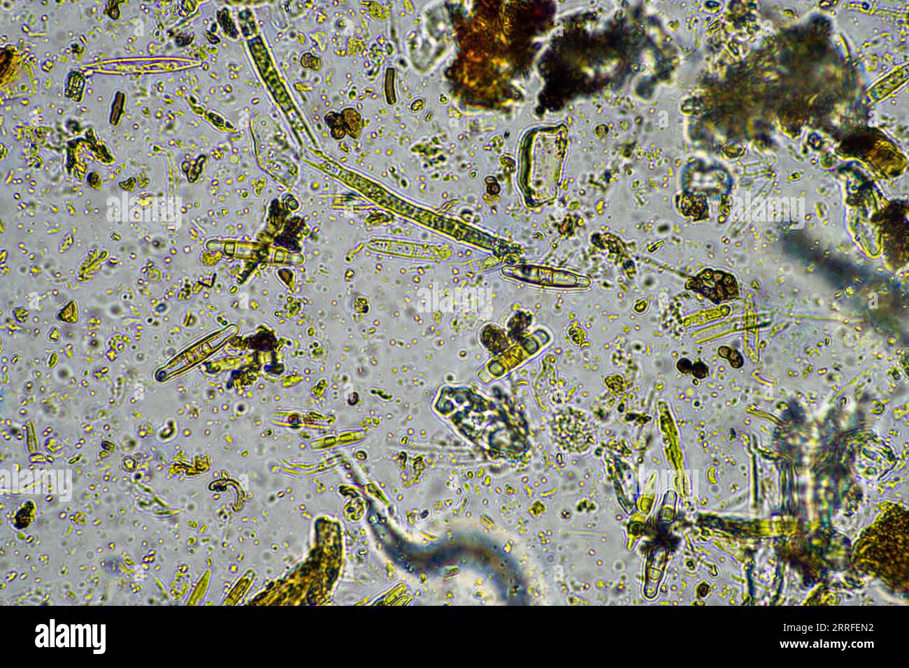soil microorganisms close up under the microscope. in a soil samlple ...