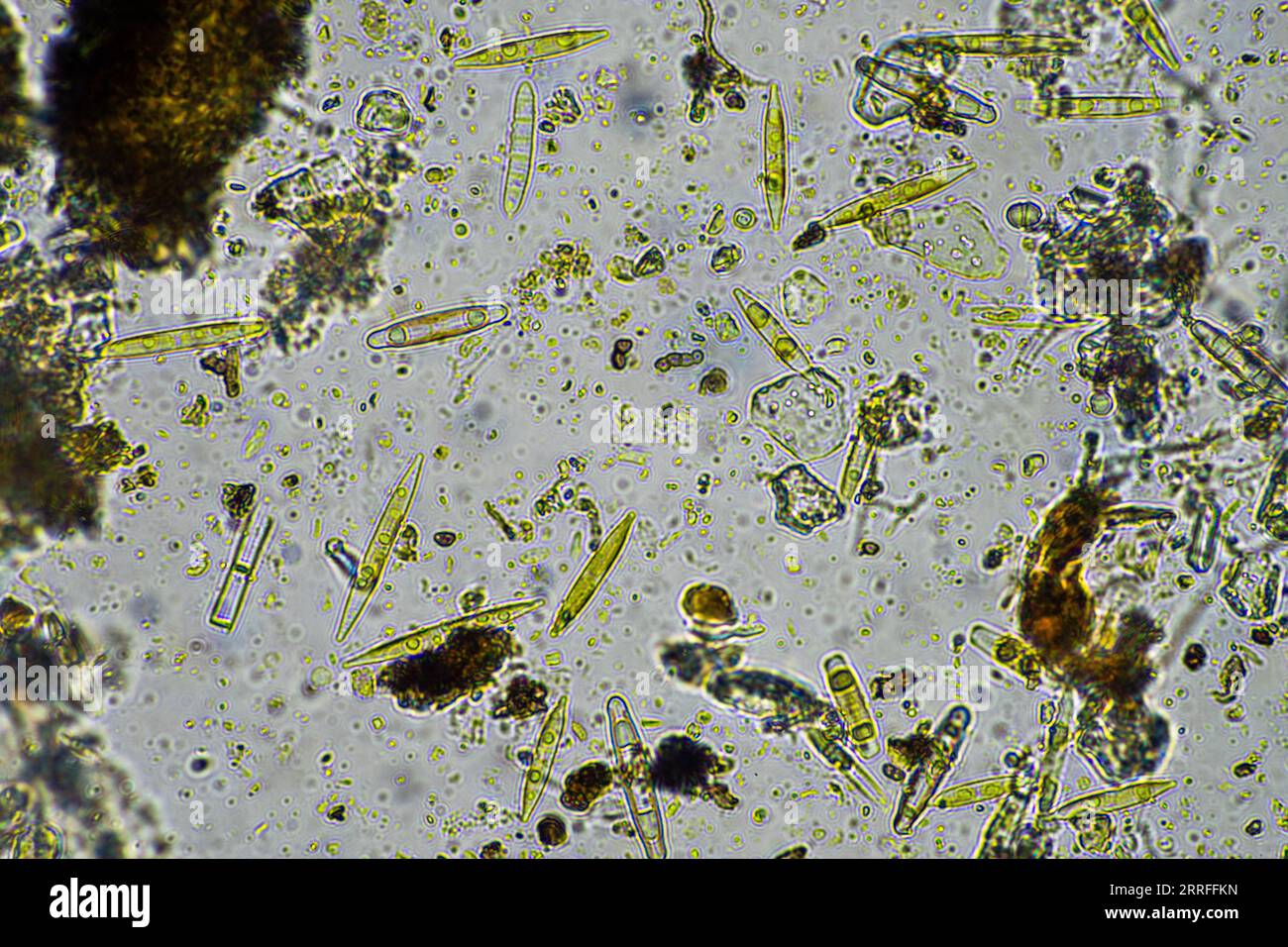 soil microorganisms close up under the microscope. in a soil samlple ...