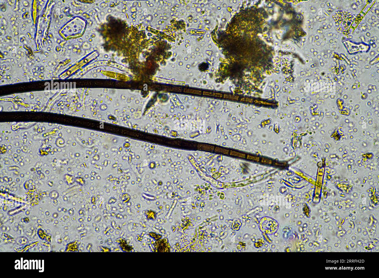 soil microorganisms close up under the microscope. in a soil samlple ...