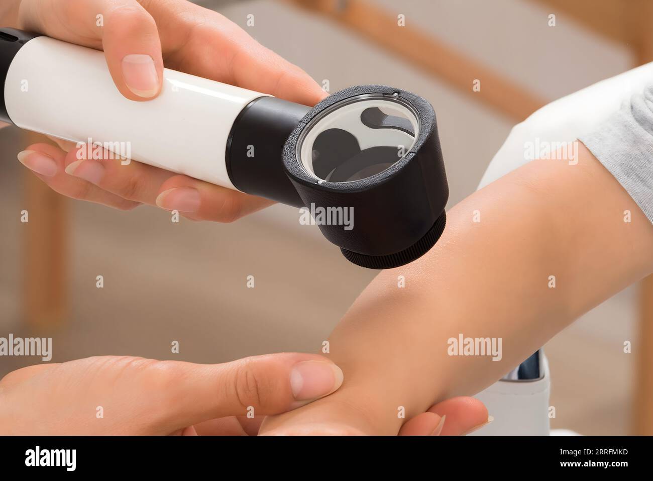 Doctor examining skin child hi-res stock photography and images - Alamy