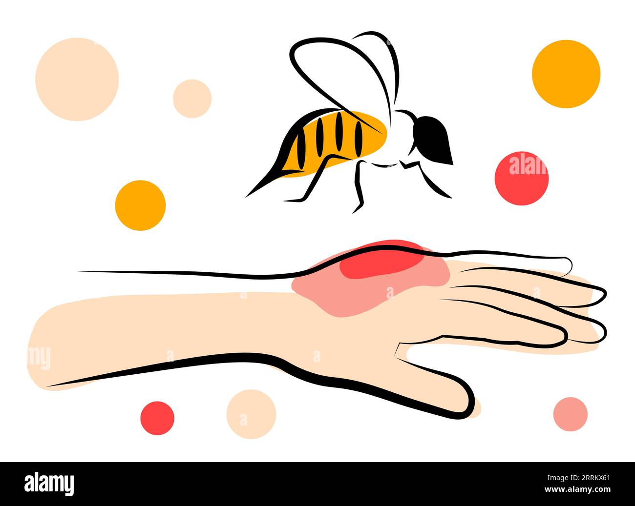 Insect bite person Stock Vector Images - Alamy