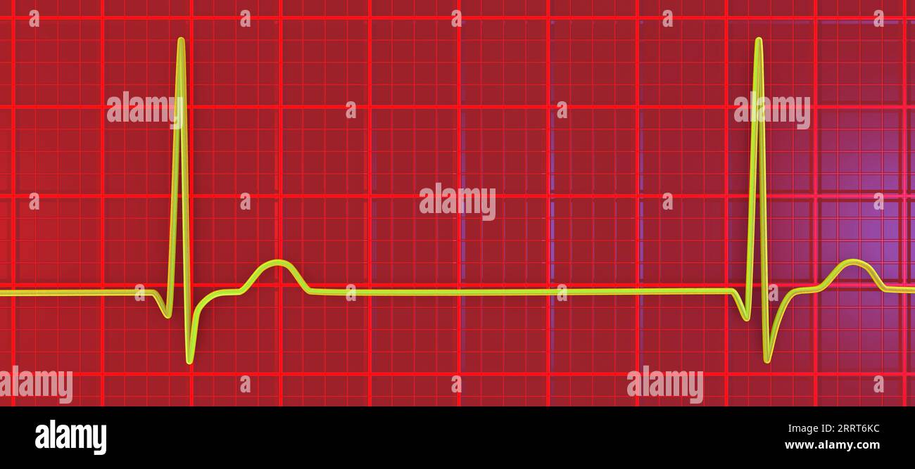 Junctional rhythm hi-res stock photography and images - Alamy