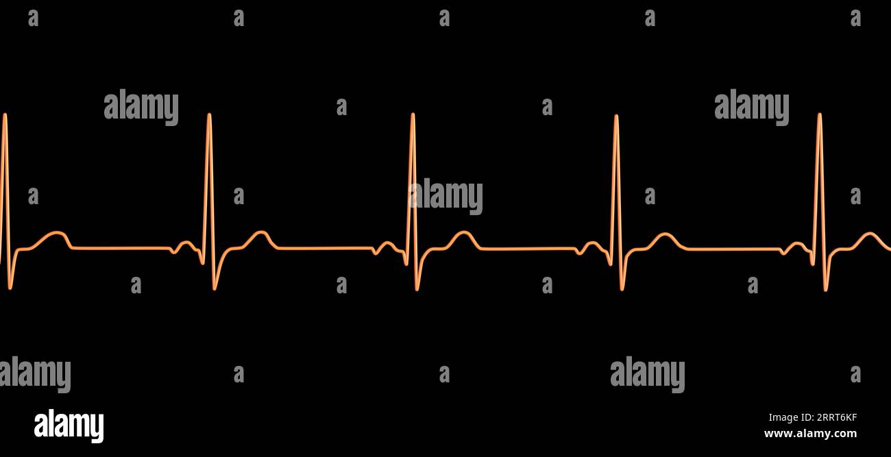 Healthy heartbeat rhythm, illustration Stock Photo - Alamy