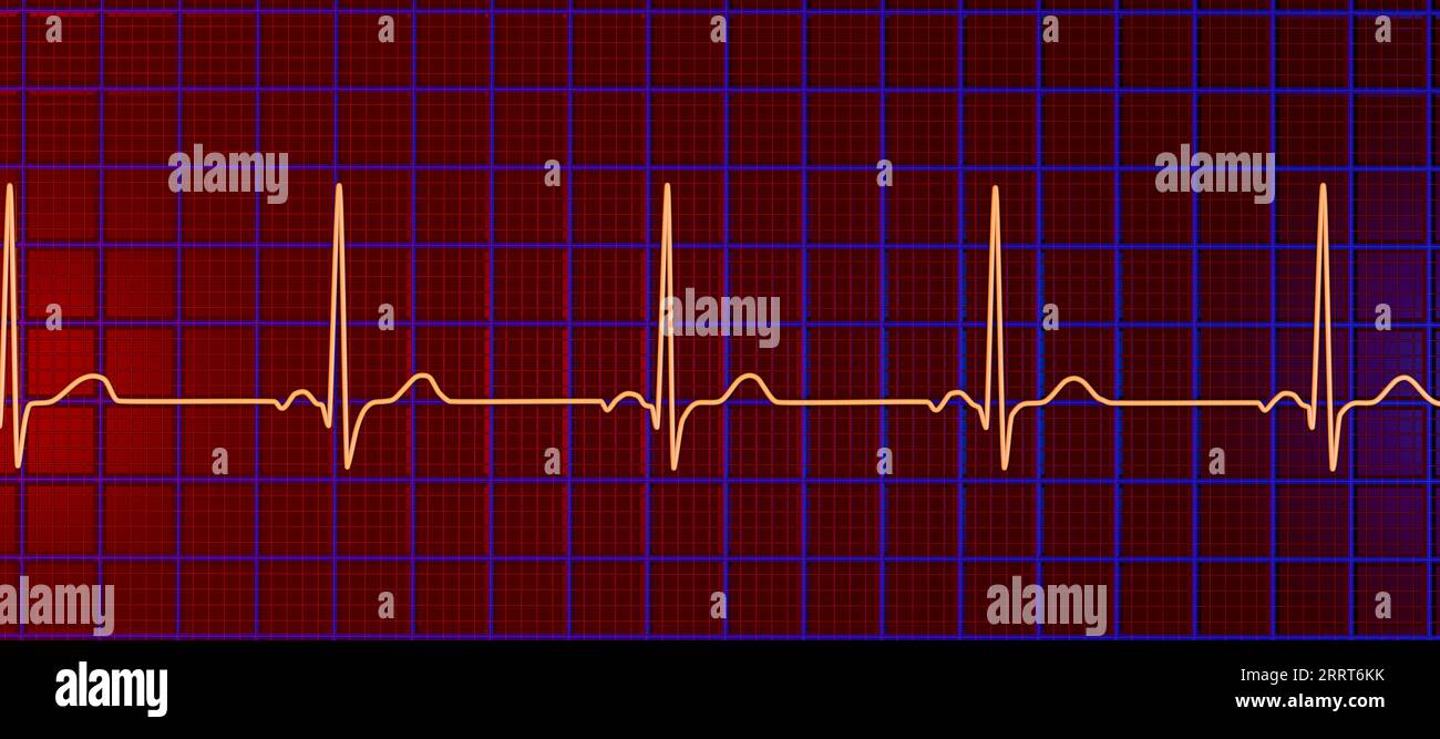 Healthy heartbeat rhythm, illustration Stock Photo - Alamy