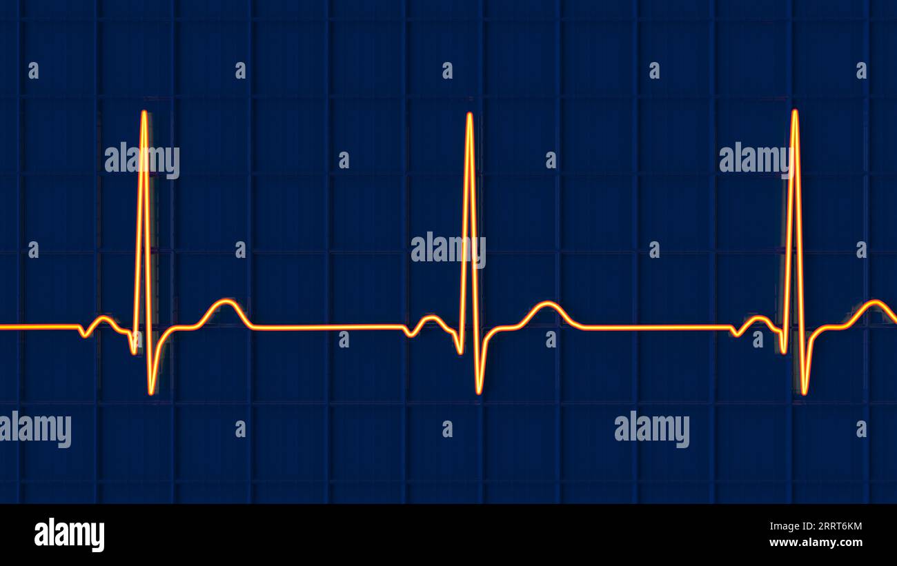 Healthy heartbeat rhythm, illustration Stock Photo - Alamy