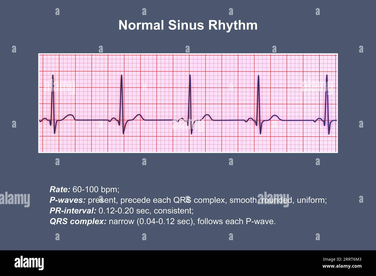Healthy heartbeat rhythm, illustration Stock Photo - Alamy