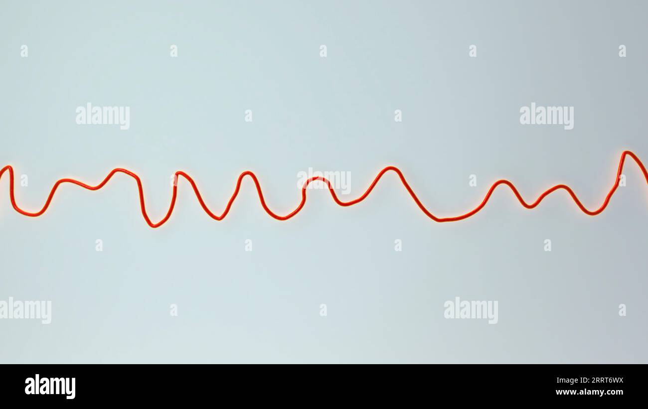 Ventricular fibrillation heartbeat rhythm, illustration Stock Photo - Alamy