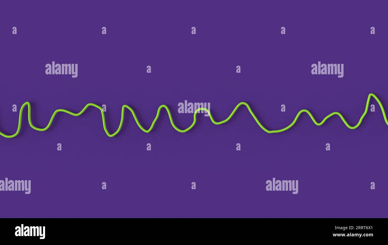 Ventricular fibrillation heartbeat rhythm, illustration Stock Photo - Alamy