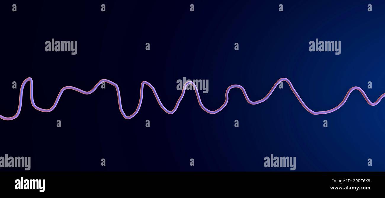 Ventricular fibrillation heartbeat rhythm, illustration Stock Photo - Alamy