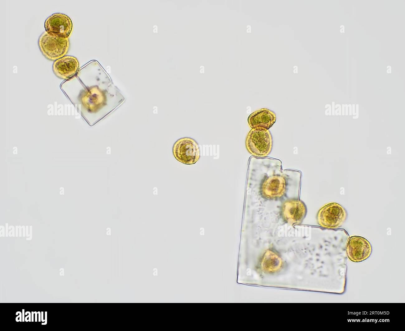 Moss Spores Microscope