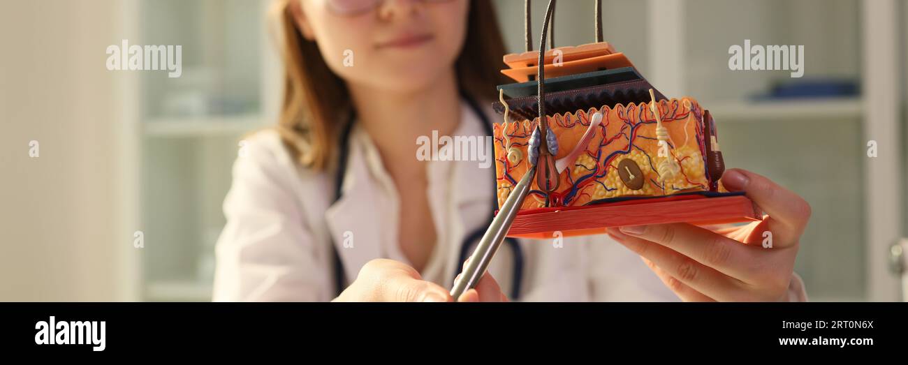 Young female dermatologist holds pen and anatomical model of human skin ...