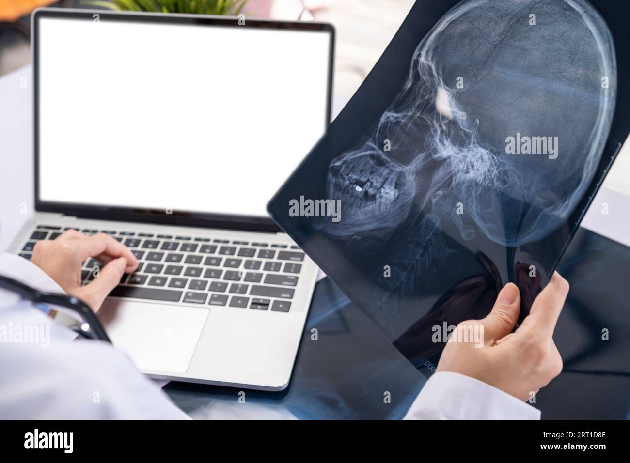 Female doctor checking x-ray film in medical laboratory at hospital ...