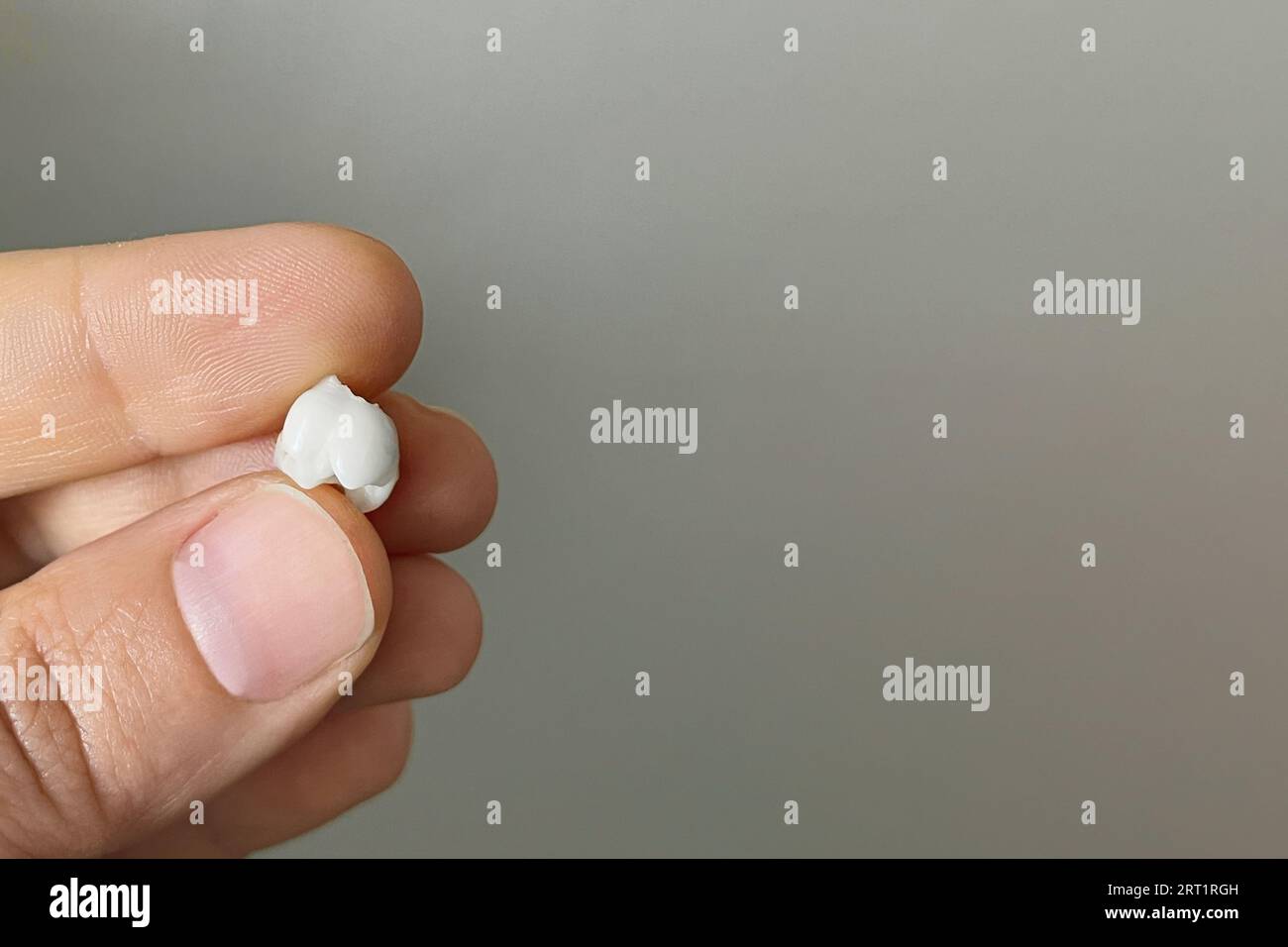 Baby tooth fell out hi-res stock photography and images - Alamy