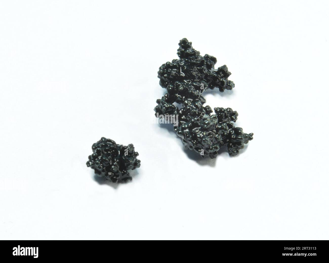 Gallstones - small stones, usually made of cholesterol, that form in ...