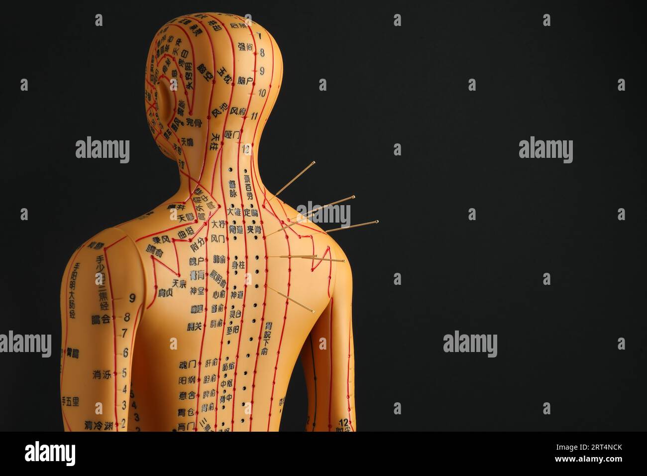 Acupuncture - alternative medicine. Human model with needles in back ...