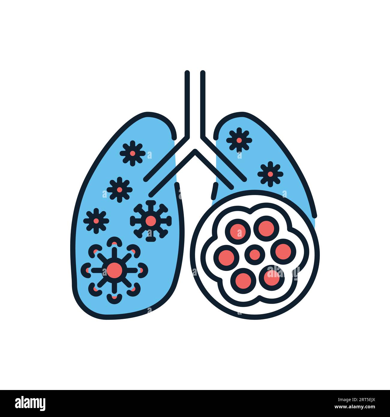 Pneumonia related vector icon. Lungs with alveoli and coronavirus ...
