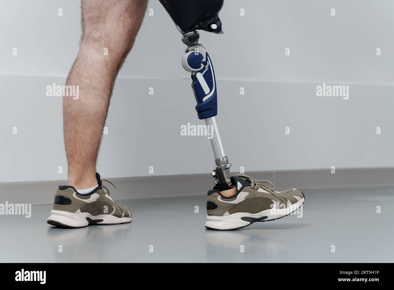 Unrecognisable male wearing prosthetic leg Stock Photo - Alamy